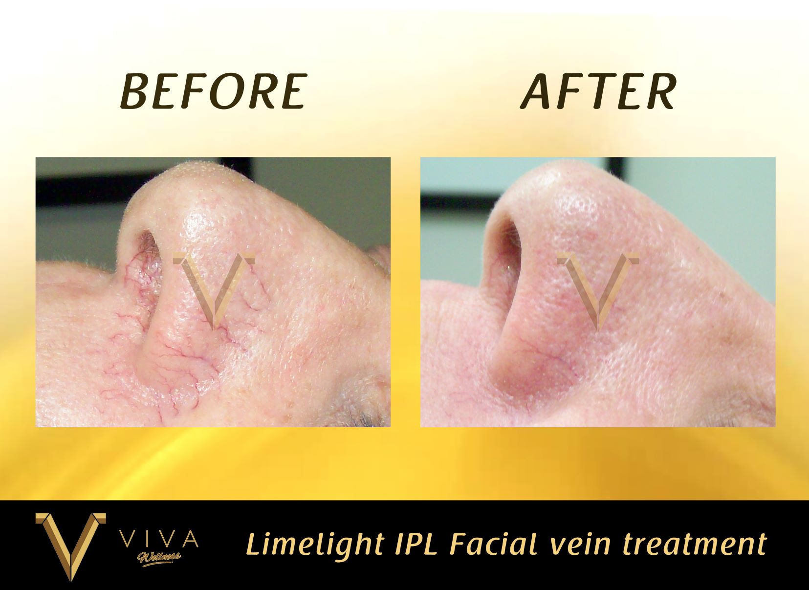 Results - Viva Wellness